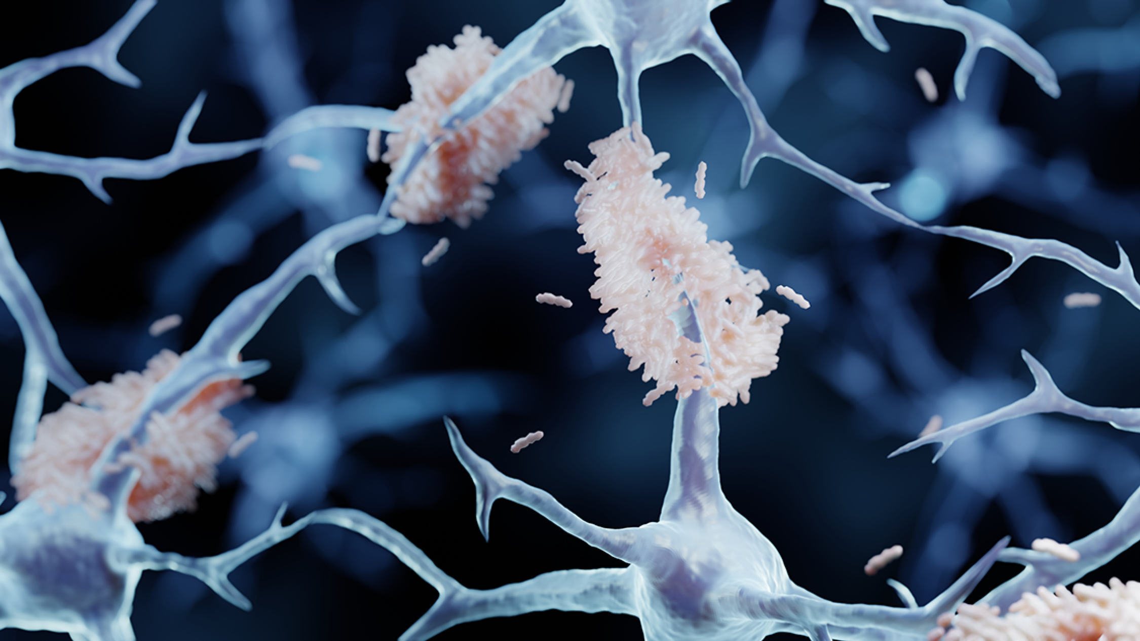 NYU researchers developing engineered immune cells to target Alzheimer’s disease | NYU Tandon ...
