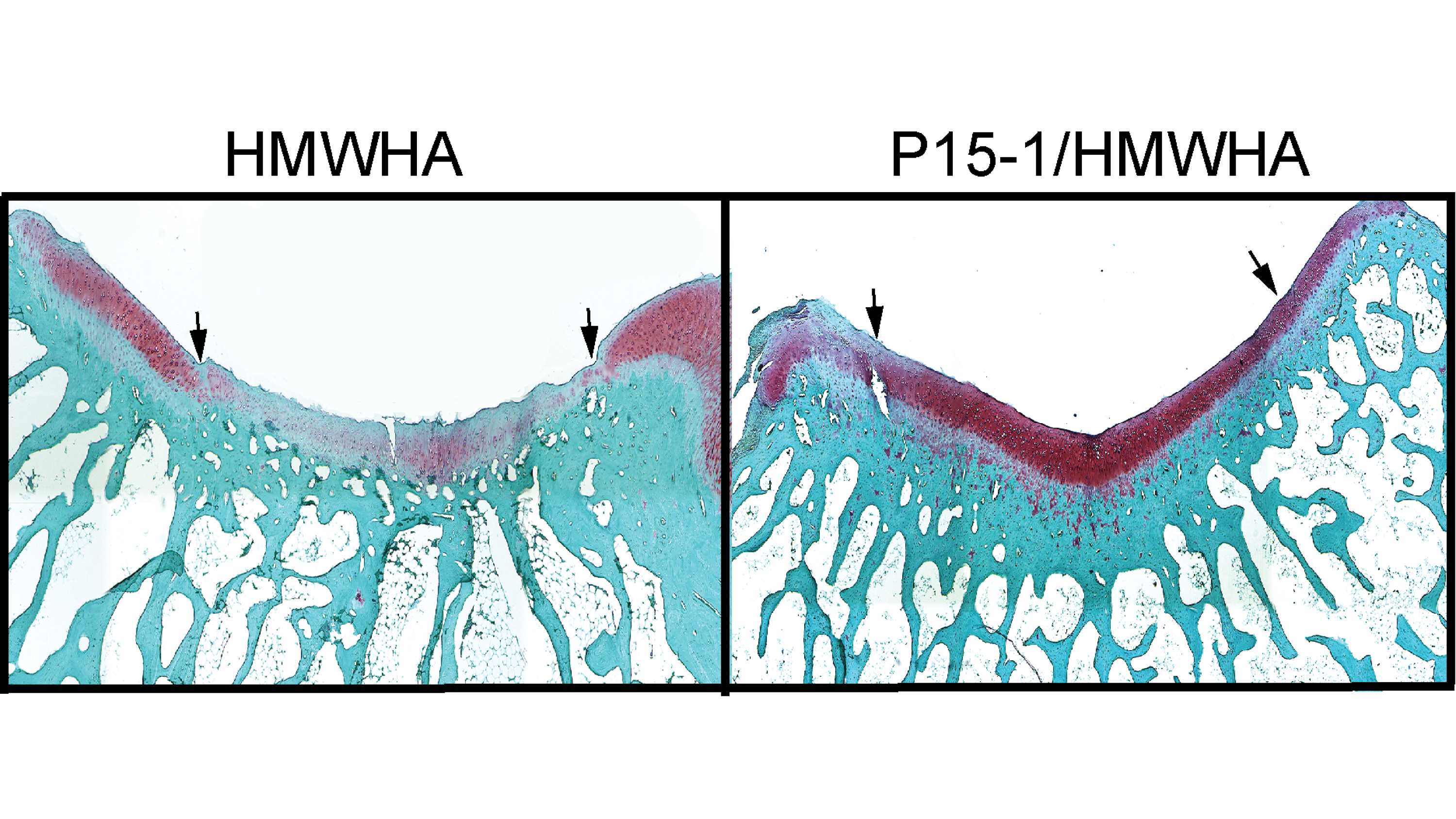 Revolutionizing cartilage repair: The role of macrophages and ...