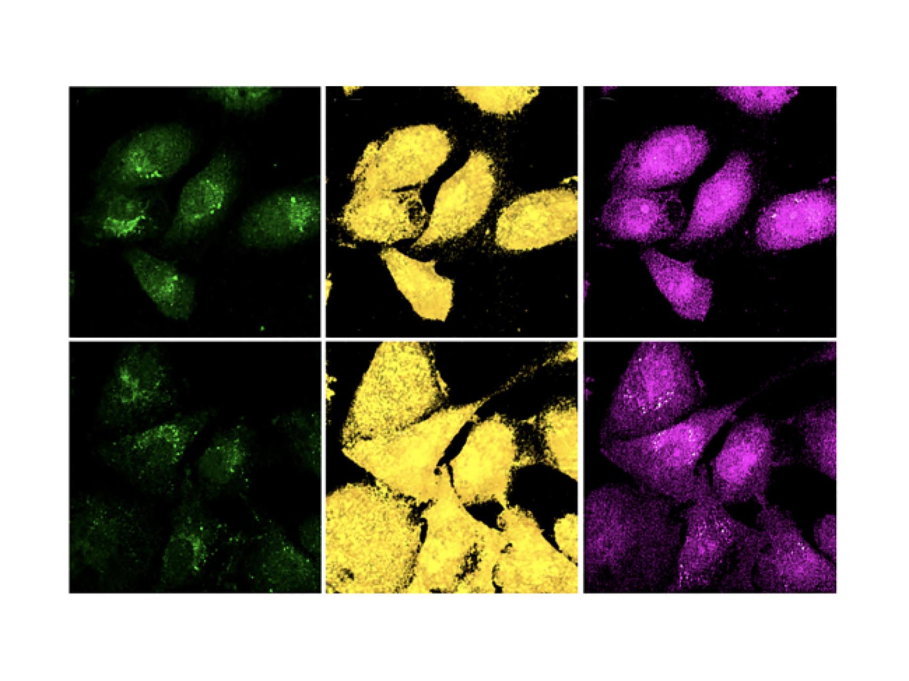 Multimodal Super Resolution Metabolic Imaging in Aging and Diseases | NYU Tandon School of ...