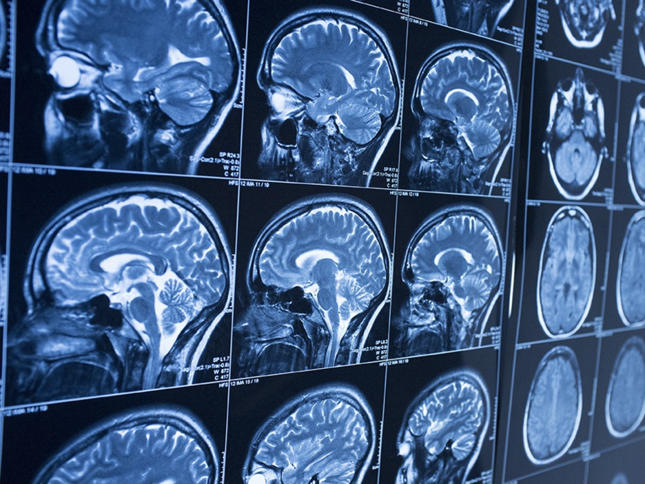 A new era of medical imaging | NYU Tandon School of Engineering