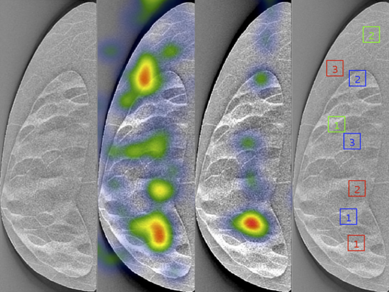 New Frontiers in Spectral X-Ray Imaging Tomography | NYU Tandon School ...