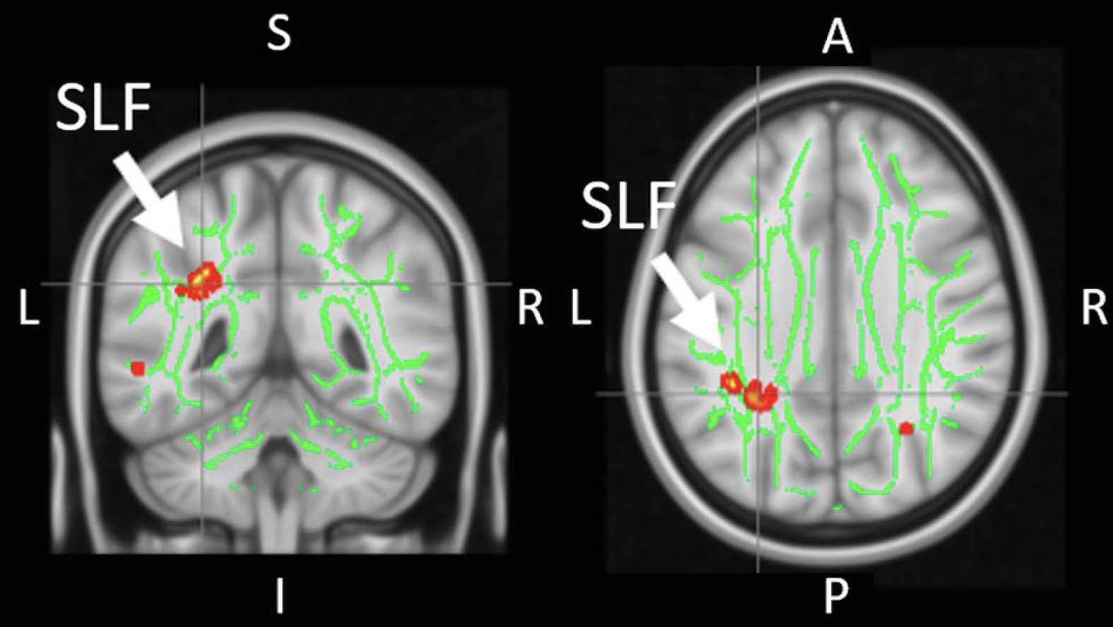 Structural, Metabolic and Functional Brain Imaging for Disease ...