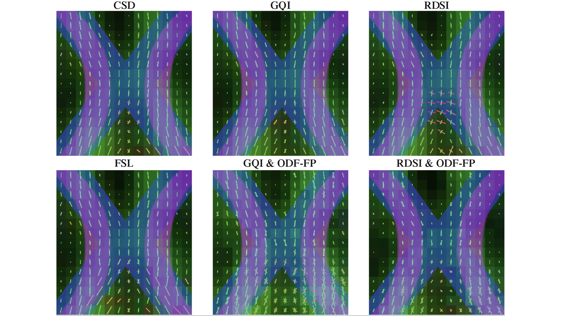 Diffusion MRI Nerve-Tract Visualization with Radial DSI and ODF ...